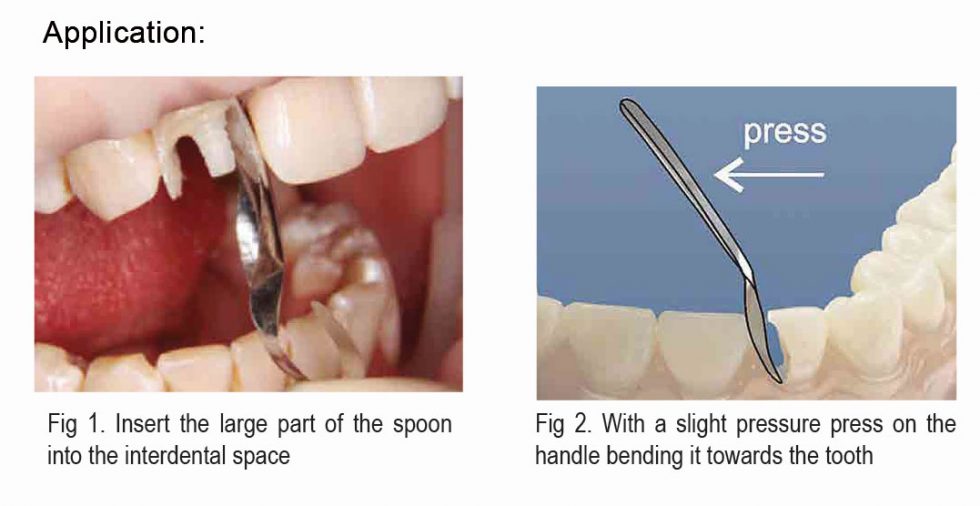 Spoon Anterior Matrix | Perident