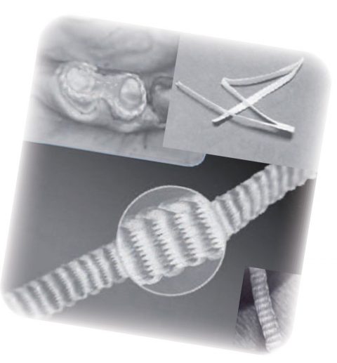 Splinting ribbon | Perident